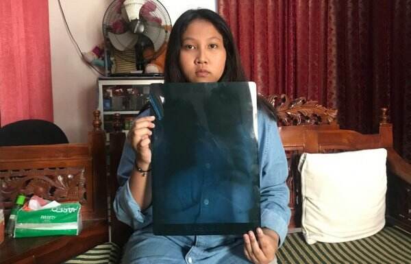 Tiap 7 Menit, Dada Febiola Sakit, Separo Paru-parunya Penuh Flek Putih ... Tiap 7 Menit, Dada Febiola Sakit, Separo Paru-parunya Penuh Flek Putih ...