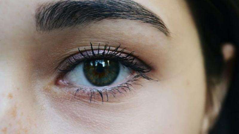 Bercak Kuning di Mata dan Hidung Bisa Jadi Tanda Kolesterol Tinggi ...